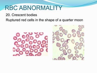 Rbc abnormality | PPTX