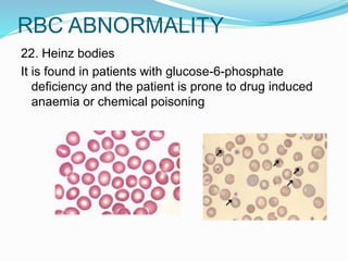 Rbc abnormality | PPTX