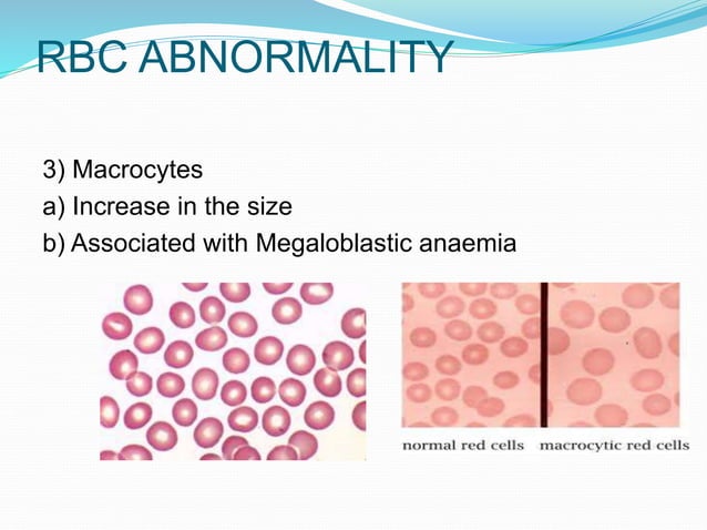 Rbc abnormality | PPTX | Blood Disorders | Diseases and Conditions