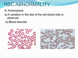 Rbc abnormality | PPTX | Blood Disorders | Diseases and Conditions