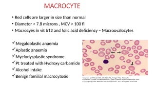 rbc ajin (1).pptx rbc morphology, morphology | PPTX | Blood Disorders ...