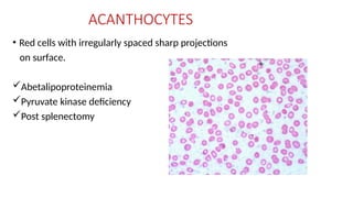 rbc ajin (1).pptx rbc morphology, morphology | PPTX
