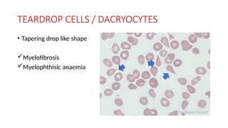 rbc ajin (1).pptx rbc morphology, morphology | PPTX