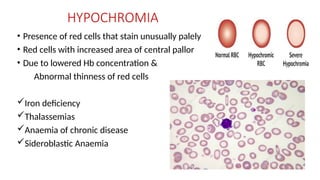 rbc ajin (1).pptx rbc morphology, morphology | PPTX