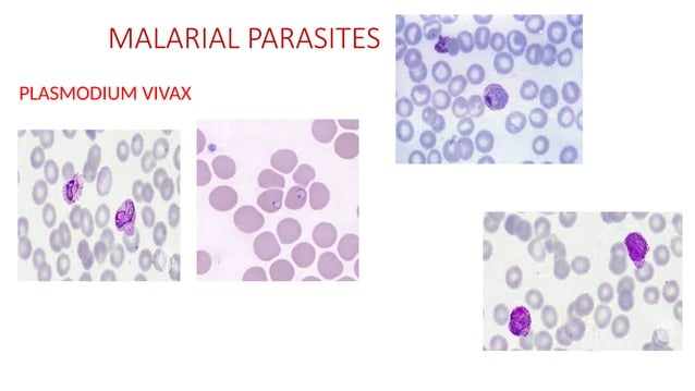 rbc ajin (1).pptx rbc morphology, morphology | PPT
