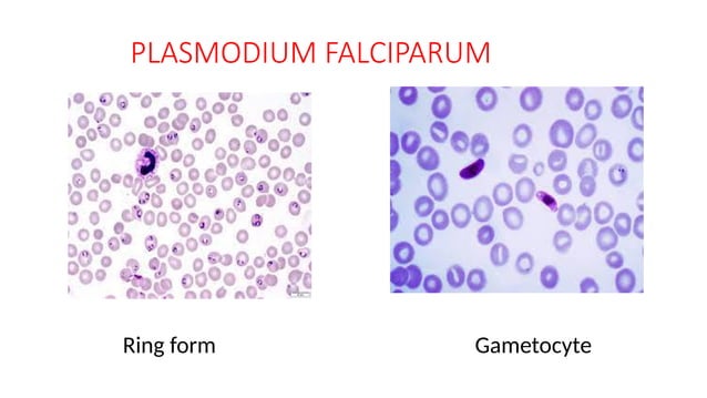 rbc ajin (1).pptx rbc morphology, morphology | PPT