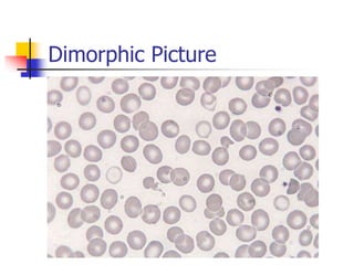 RBC & Anaemia other than H.A.pptpathology | PPT