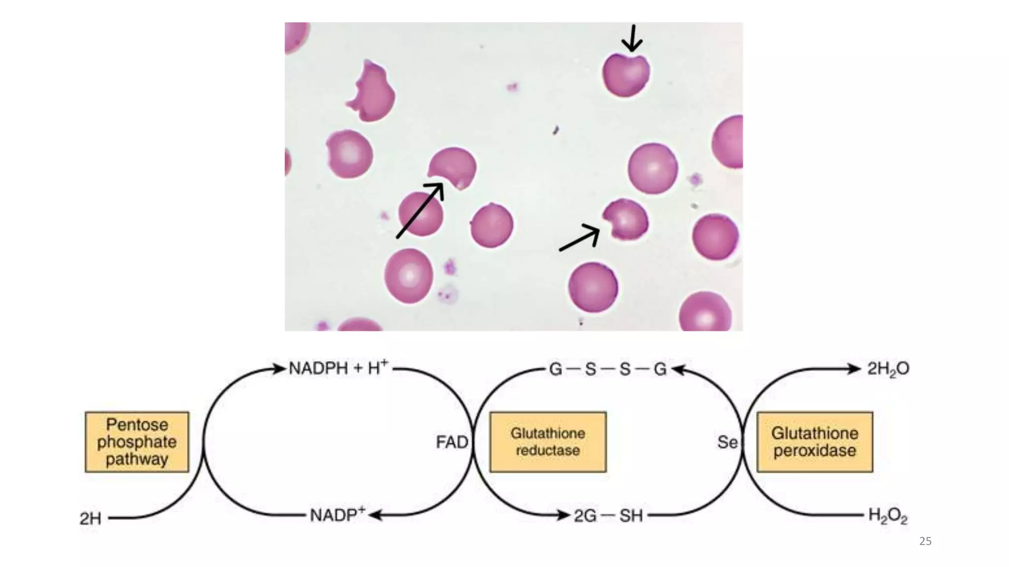Metabolism of RBC and RBC Enzymopathies | PPTX