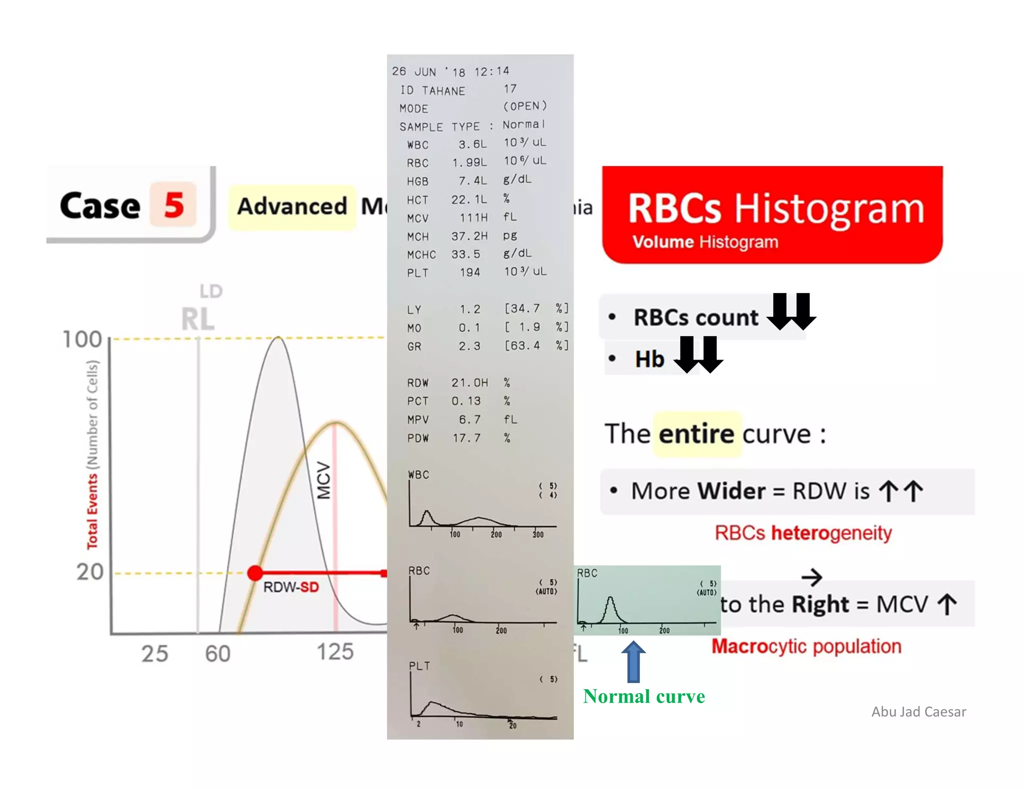RBC Histogram | PDF
