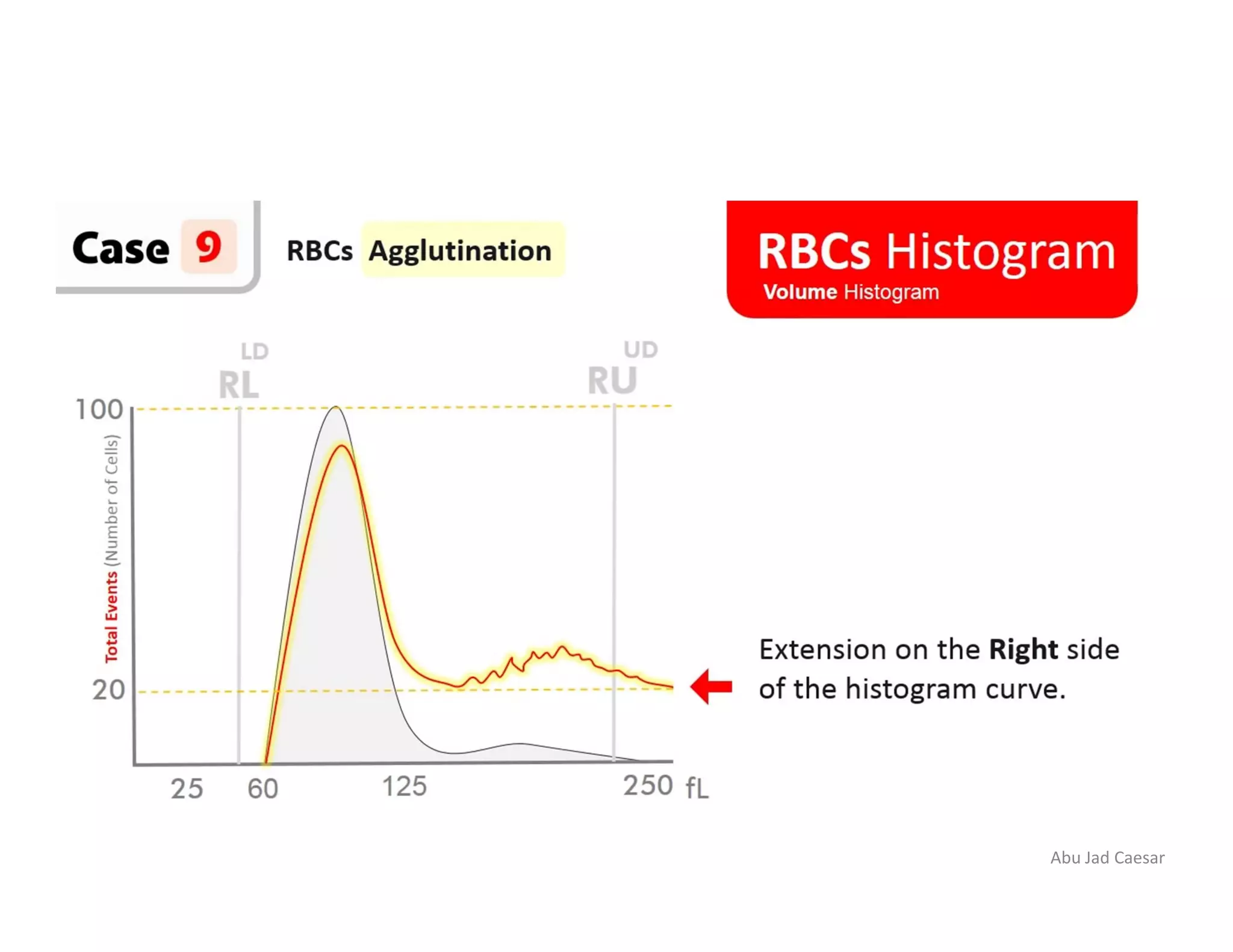 RBC Histogram | PDF