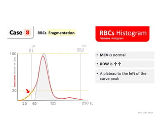 RBC Histogram | PDF