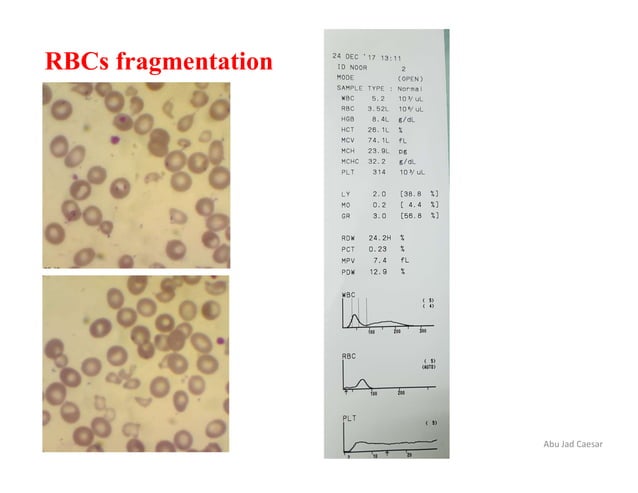 RBC Histogram | PDF