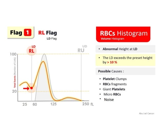 RBC Histogram