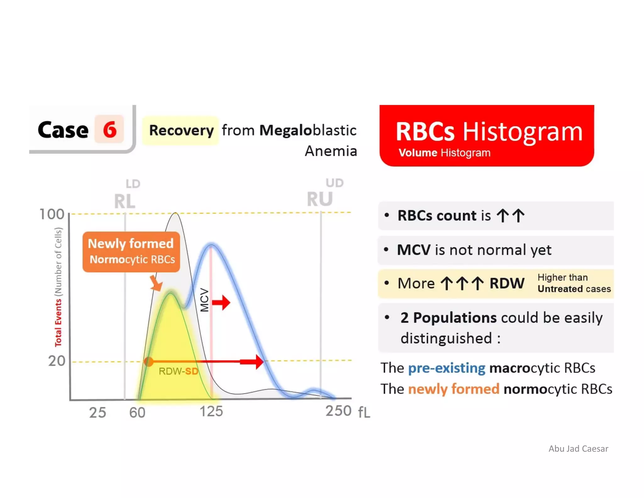 Updated - RBC histogram | PDF | Blood Disorders | Diseases and Conditions