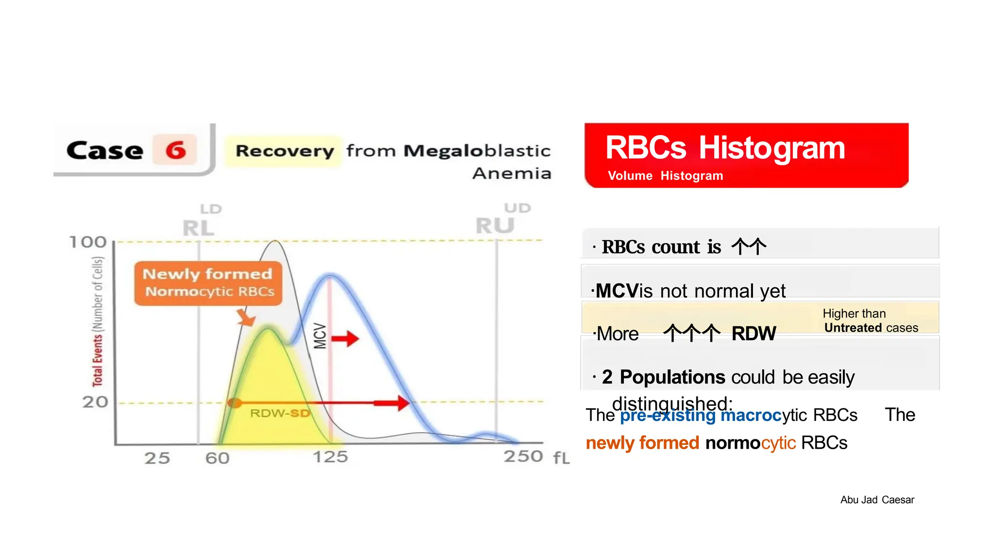 RBC HISTOGRAM and cell blood counts.pptx