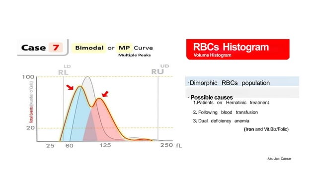 RBC HISTOGRAM and cell blood counts.pptx
