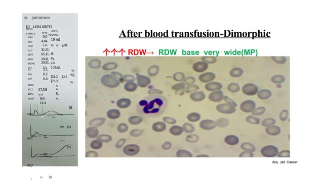 RBC HISTOGRAM and cell blood counts.pptx