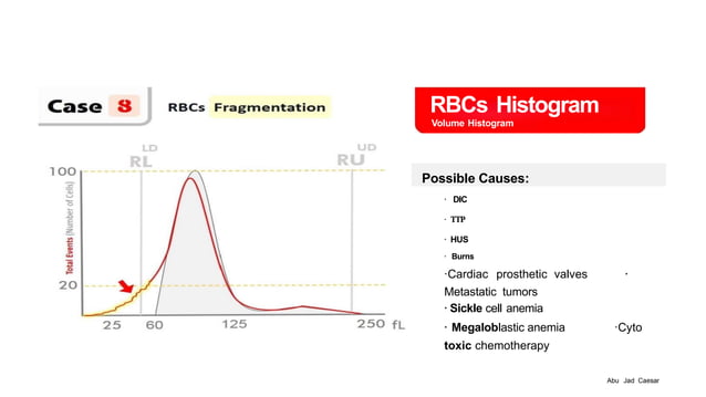 RBC HISTOGRAM and cell blood counts.pptx