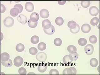 Rbc inclusion ())))) | PPTX