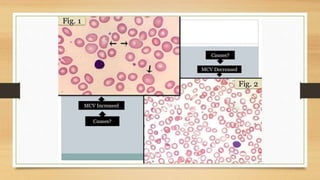 RBC INDICES final.pptx