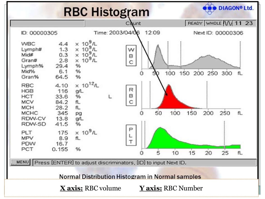 Rbc indices