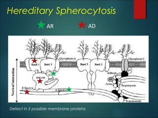 RBC Membrane Defects | PPT