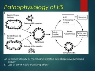 RBC Membrane Defects | PPT