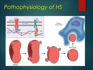 RBC Membrane Defects | PPT
