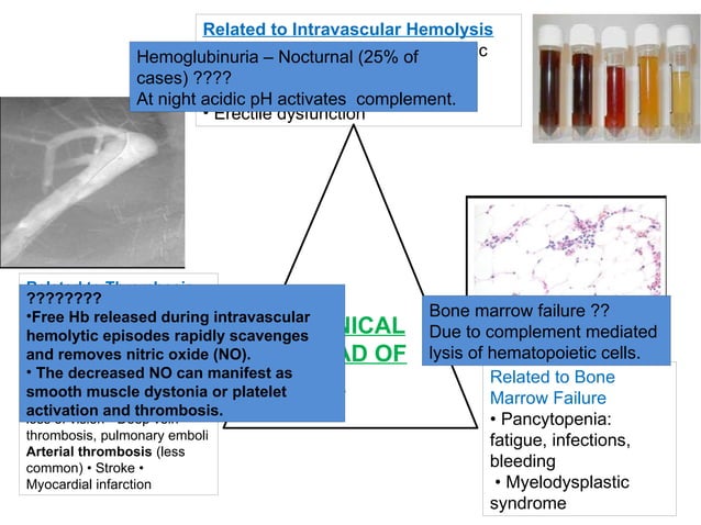 RBC MEMBRANE DEFECTS final presentation.pptx
