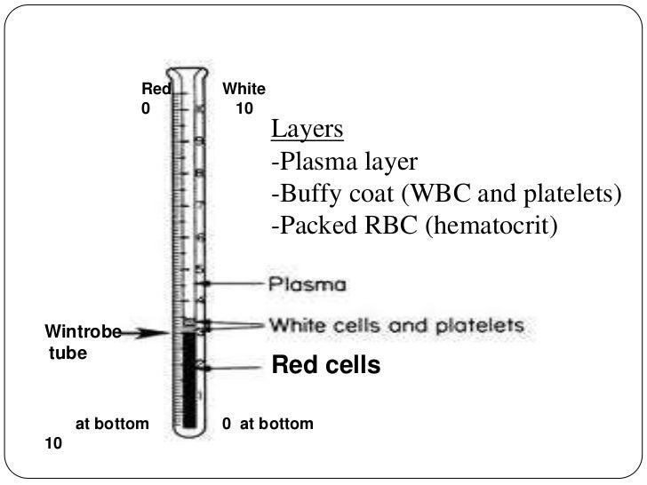 😀 Wintrobe method. Method Determine of Erythrocyte Sedimentation Rate ...