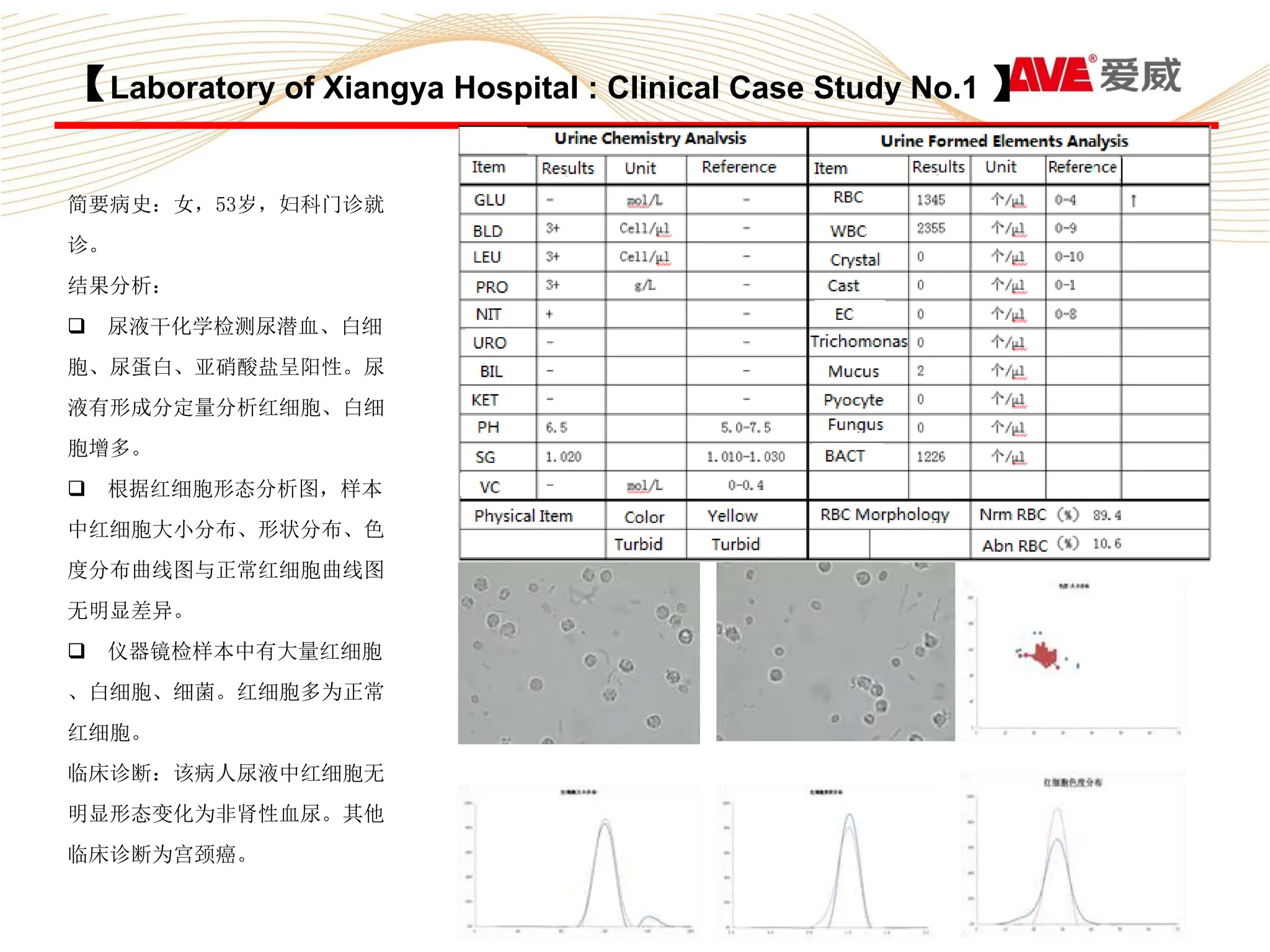 rbc morphological analysis. rbc morphological analysis | PPT