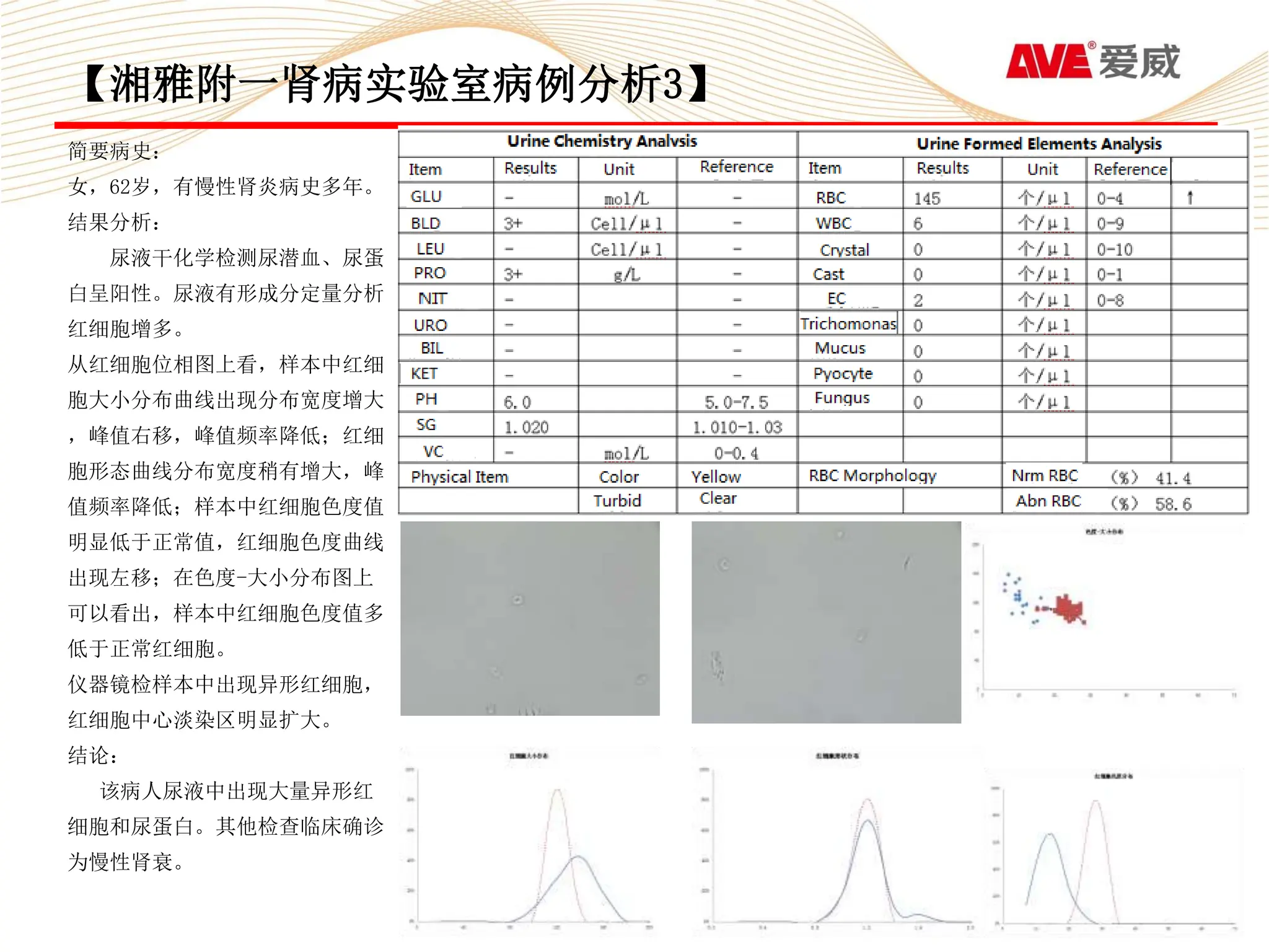 rbc morphological analysis. rbc morphological analysis | PPT