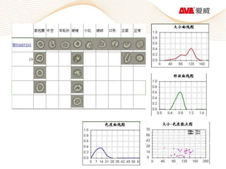 rbc morphological analysis. rbc morphological analysis | PPT