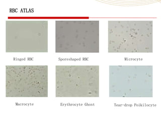 rbc morphological analysis. rbc morphological analysis | PPT