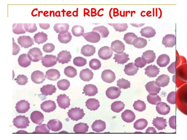 Rbcmorphology 140722103459-phpapp02 - copy
