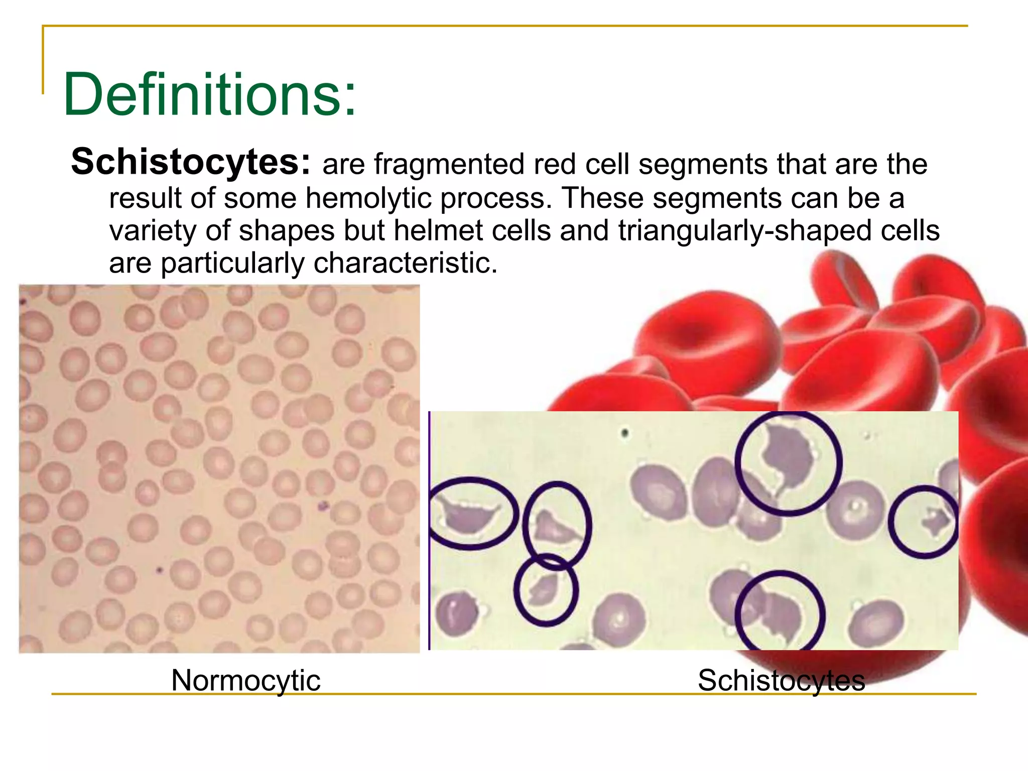 RBC morphology and Disease that may be associated with abnormal ...