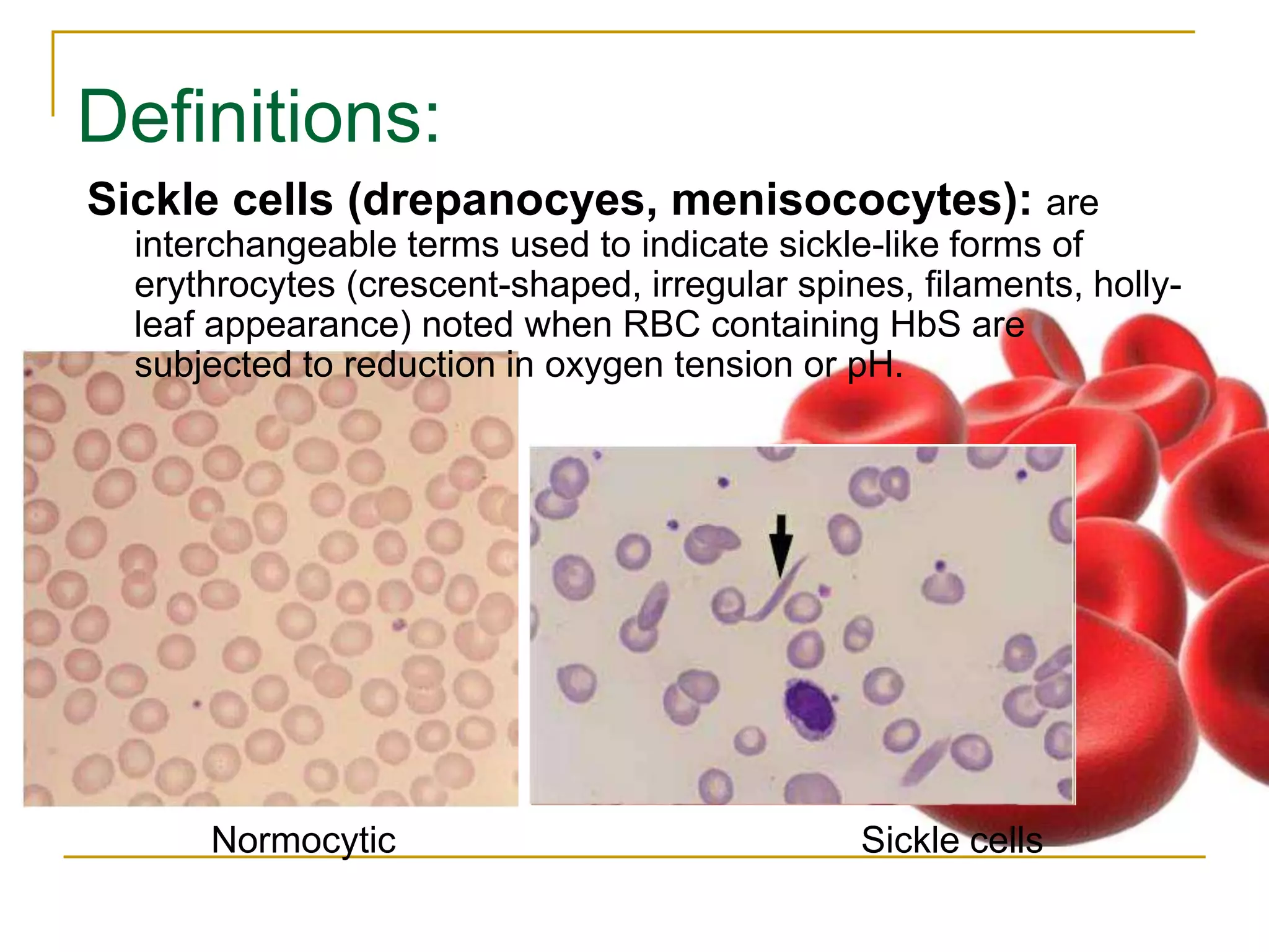 RBC morphology and Disease that may be associated with abnormal ...