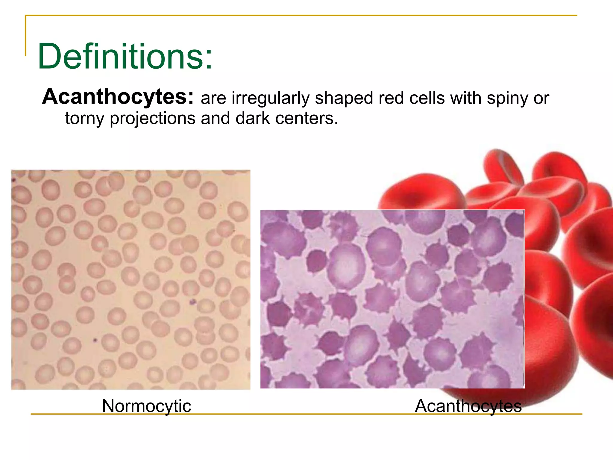 RBC morphology and Disease that may be associated with abnormal ...