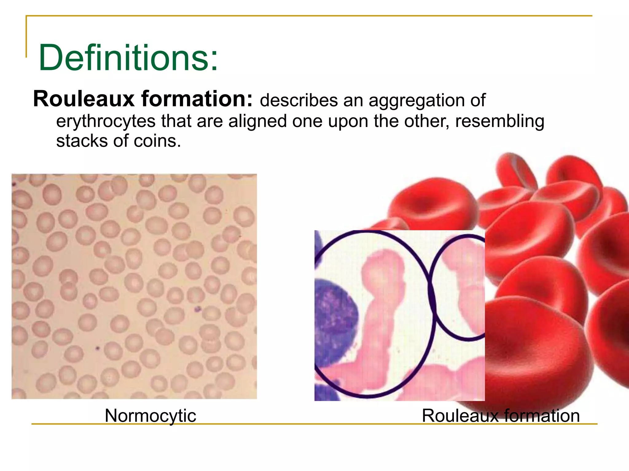 RBC morphology and Disease that may be associated with abnormal ...