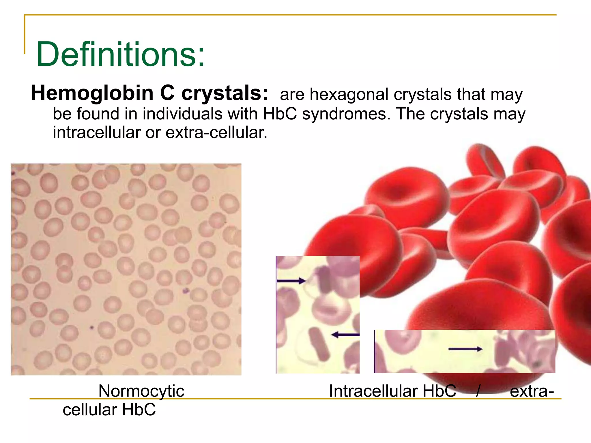 RBC morphology and Disease that may be associated with abnormal ...