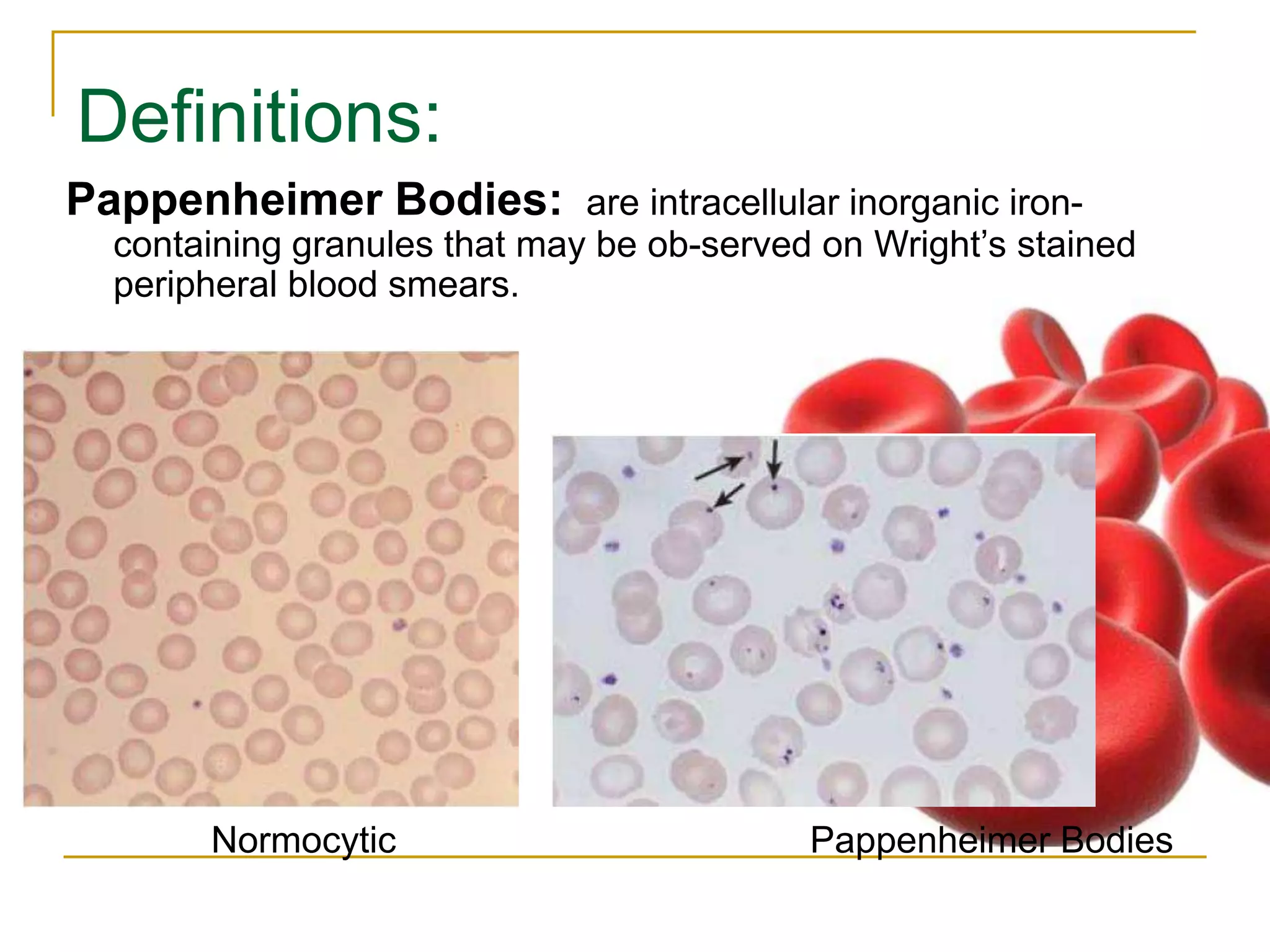 RBC morphology and Disease that may be associated with abnormal ...