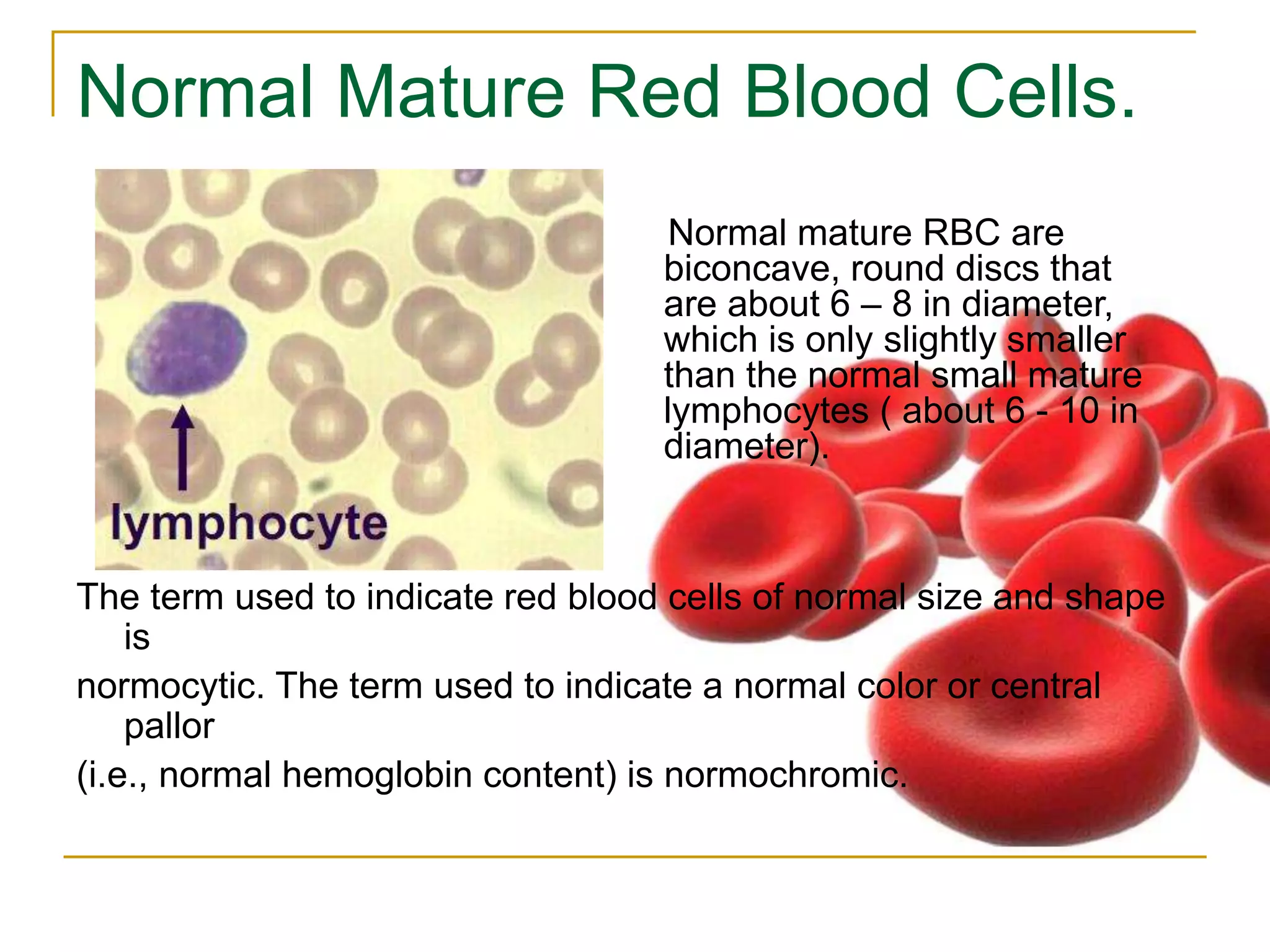 RBC morphology and Disease that may be associated with abnormal ...