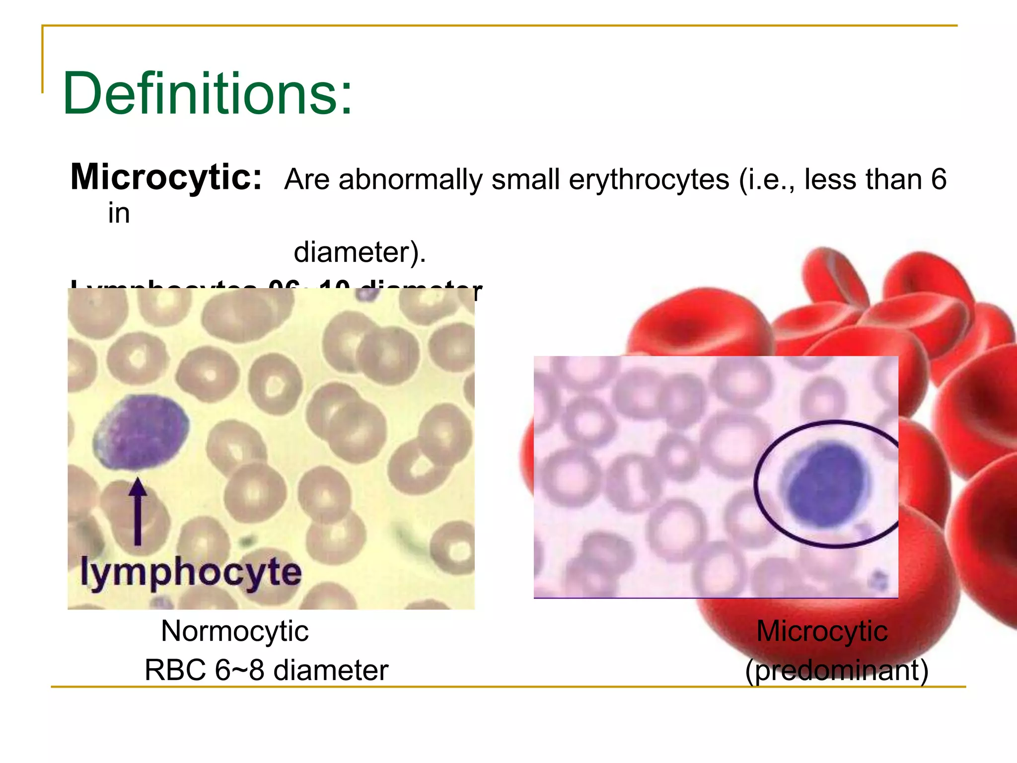 RBC morphology and Disease that may be associated with abnormal ...