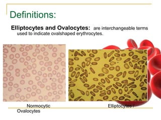 RBC morphology and Disease that may be associated with abnormal ...