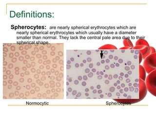 RBC morphology and Disease that may be associated with abnormal ...