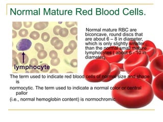 RBC morphology and Disease that may be associated with abnormal ...