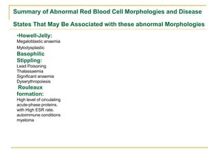 RBC morphology and Disease that may be associated with abnormal ...