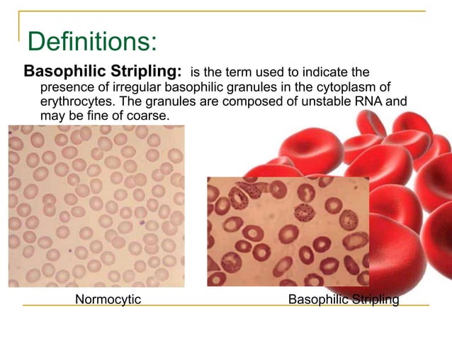 RBC morphology and Disease that may be associated with abnormal ...