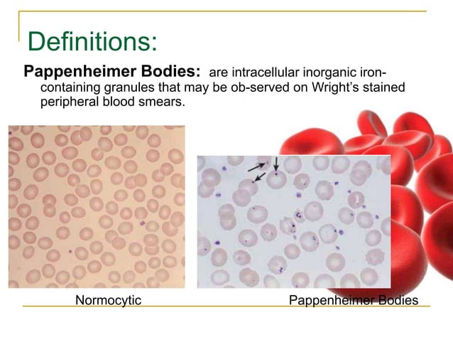 RBC morphology and Disease that may be associated with abnormal ...