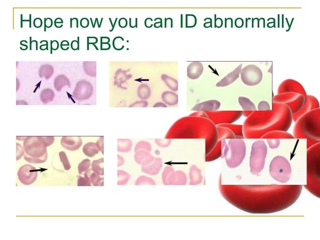 RBC morphology and Disease that may be associated with abnormal ...